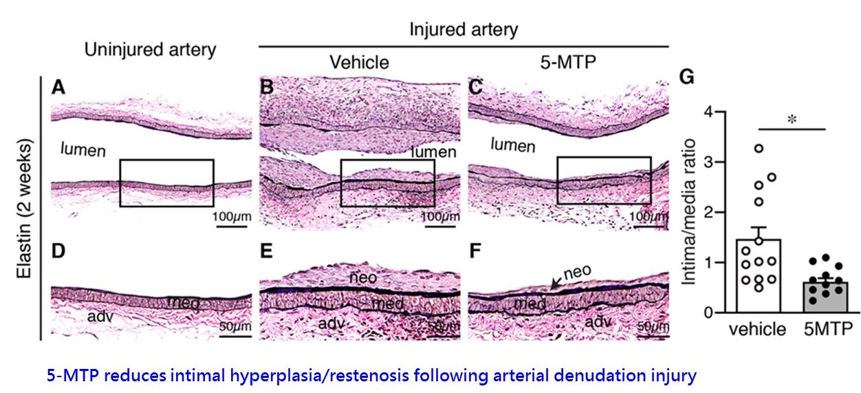 5-MTP ameliorates arterial denudation-induced intimal hyperplasia via ...